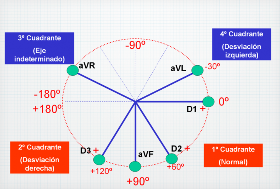 CardioTruco: cálculo eje cardíaco - Cardioprimaria Ferrol