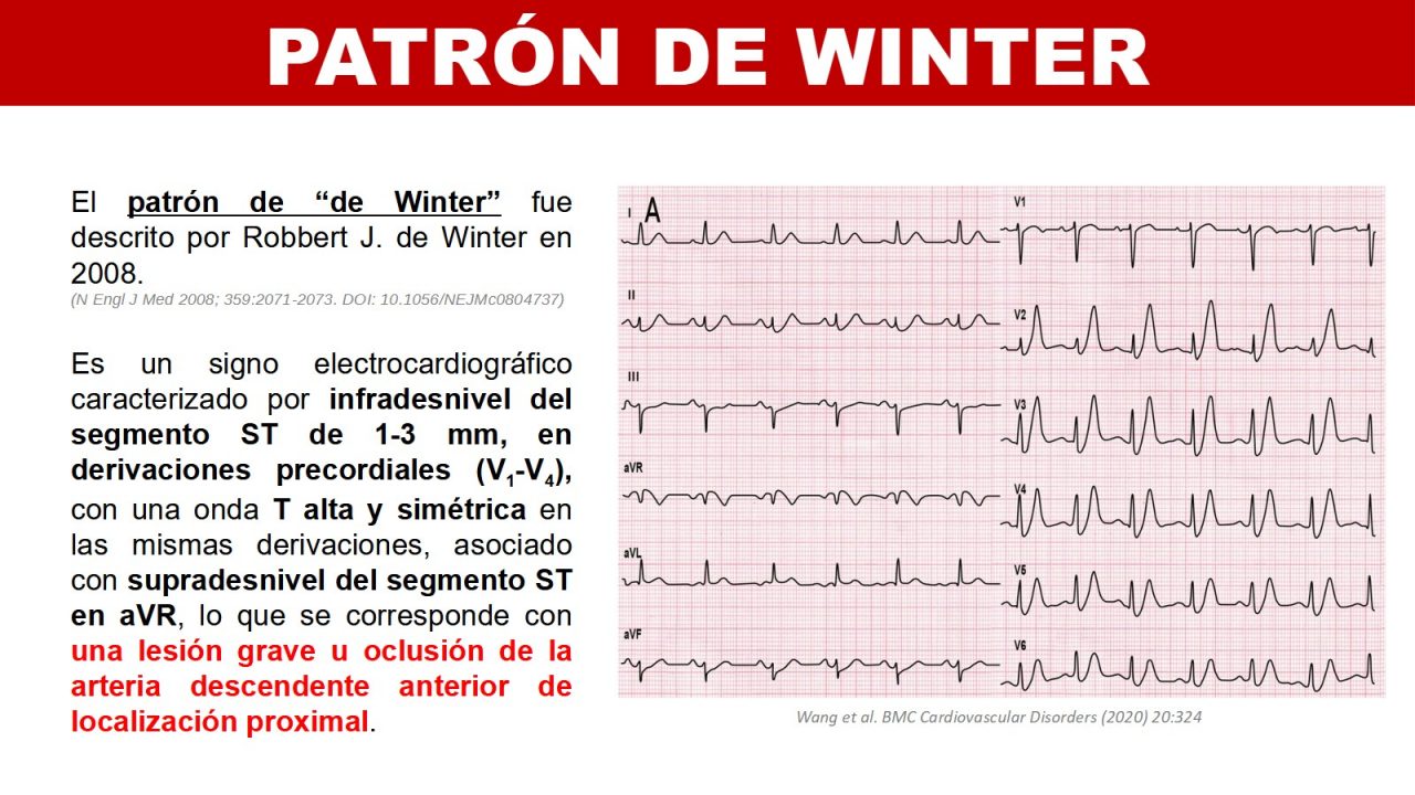 CardioTruco: patrón "de Winter" - Cardioprimaria Ferrol