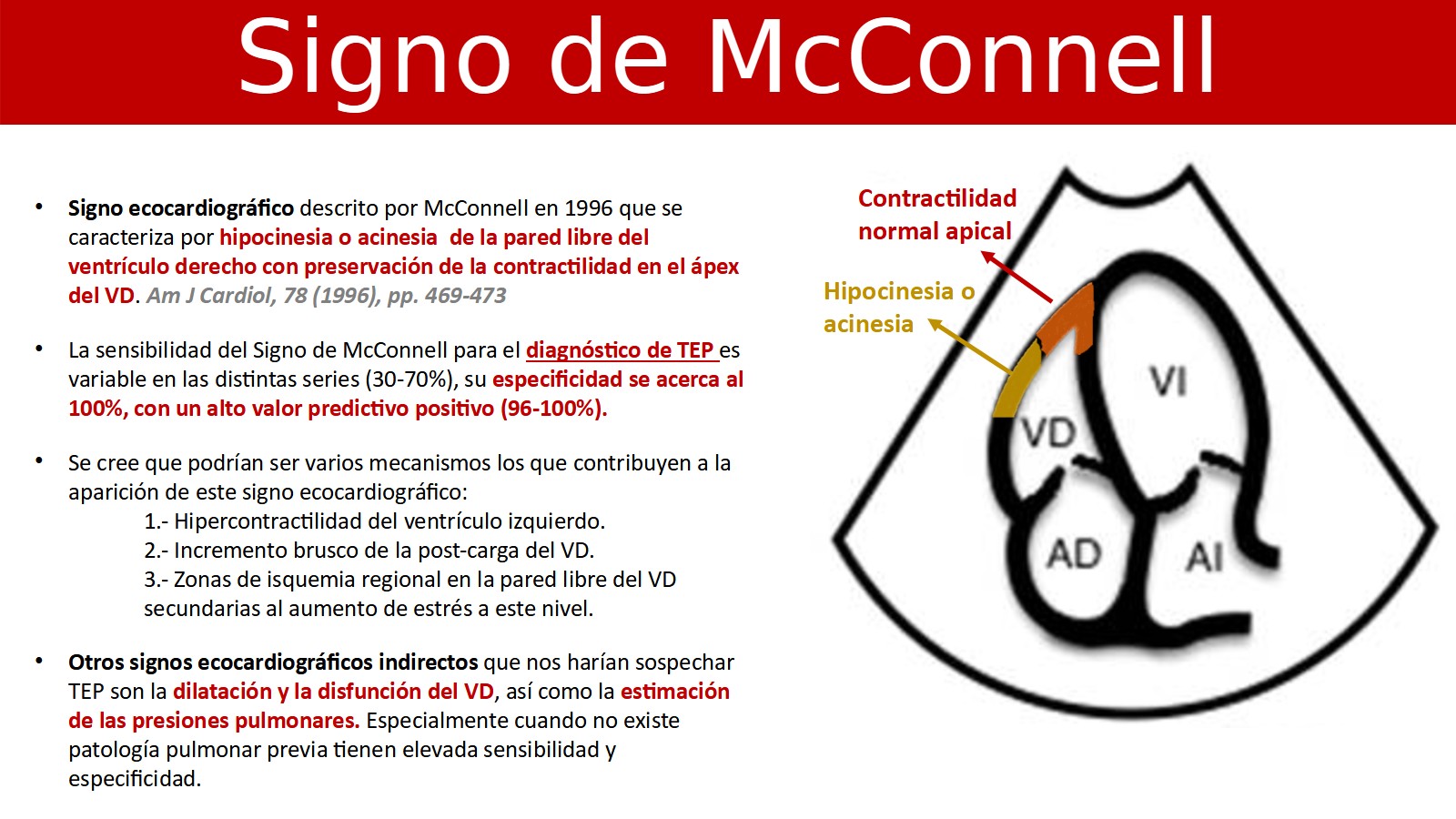CardioTruco: signo de McConnell - Cardioprimaria Ferrol
