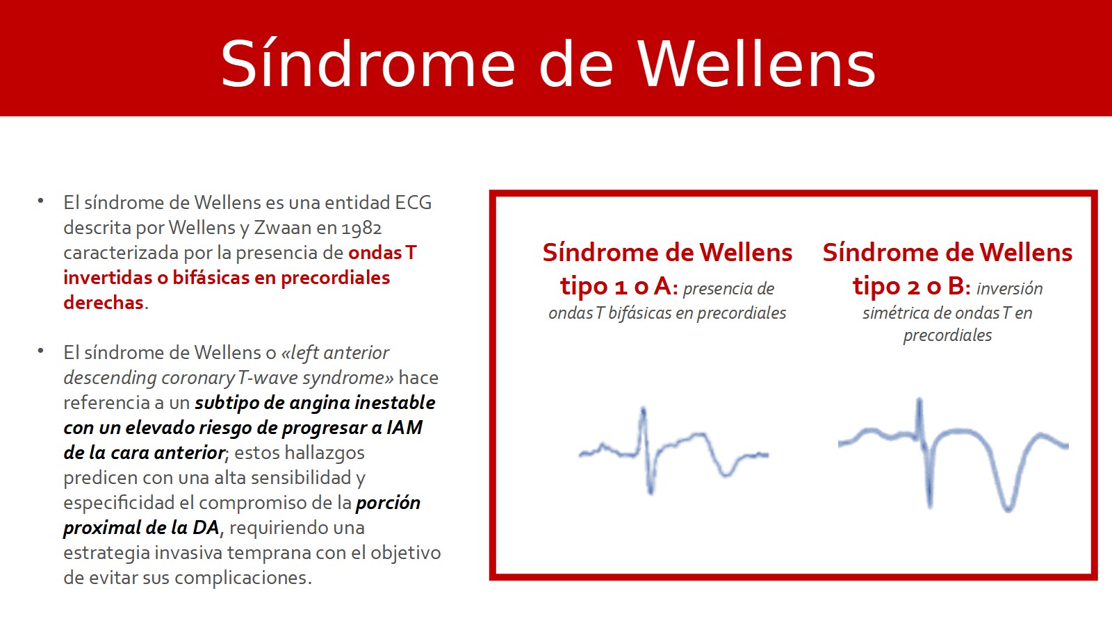CardioTruco: Síndrome de Wellens - Cardioprimaria Ferrol